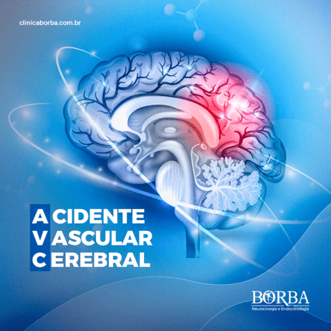 Você sabe o que é um AVC? | Clínica Borba